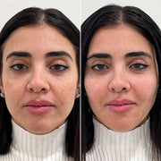 Face Fixes - BeautyFix MedSpa - Save up to 70% all Botox & Fillers