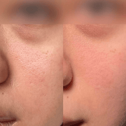 Face Fixes - BeautyFix MedSpa - Save up to 70% all Botox & Fillers