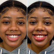 Face Fixes - BeautyFix MedSpa - (212) 366-4787